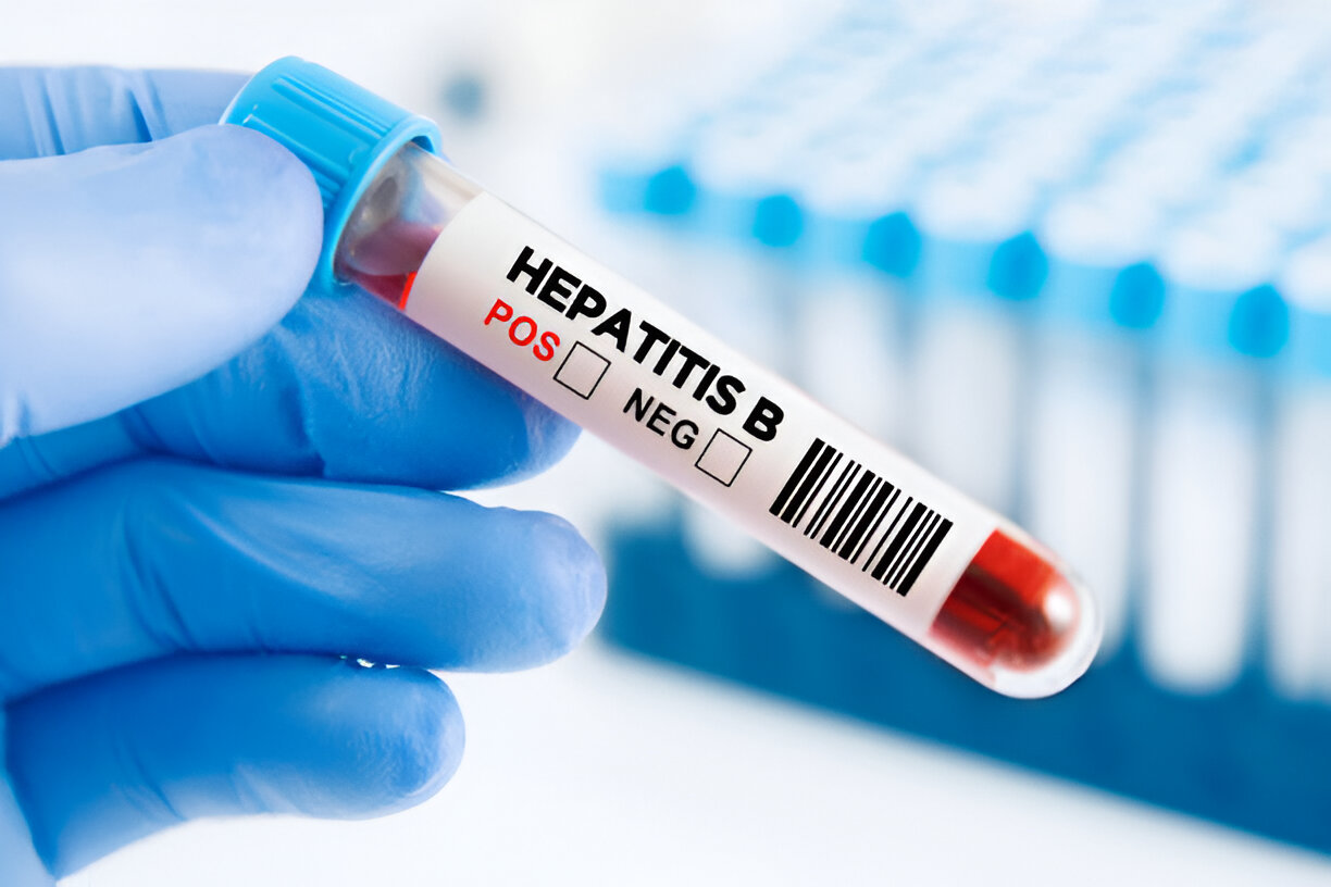 Hepatitas B: simptomai ir gydymo būdai - SveikaAkis.lt