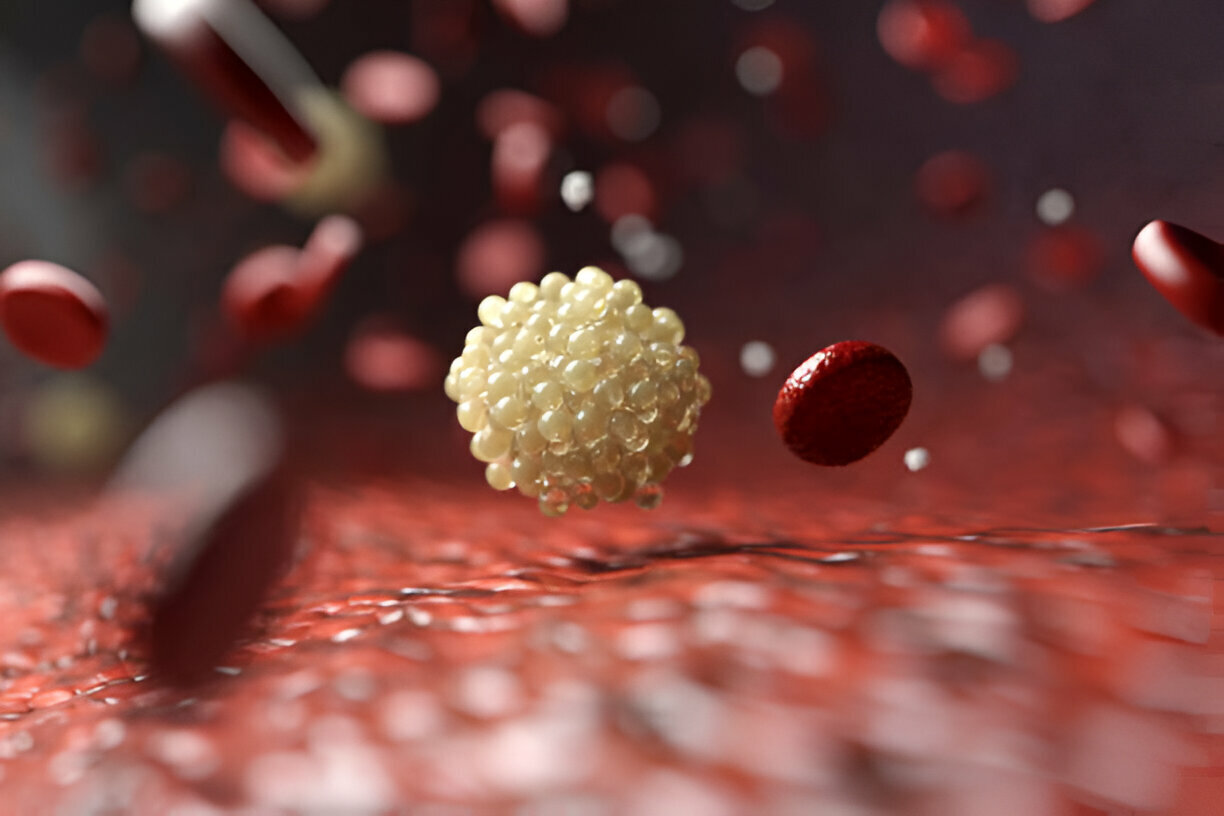 Blogasis cholesterolis - kas tai ir kaip jį sumažinti - SveikaAkis.lt