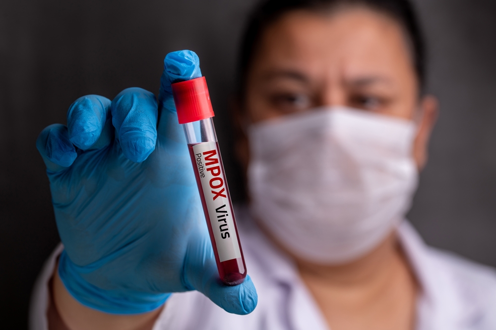 Odos grybelis: simptomai ir efektyvus gydymas - SveikaAkis.lt