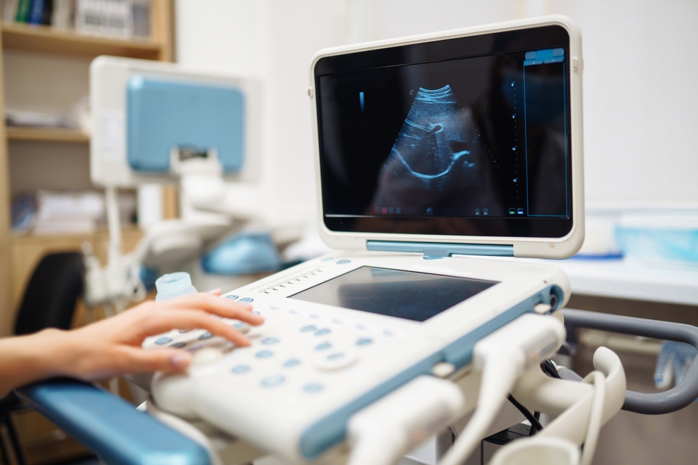 Ultragarso tyrimas dėl prostatos vėžio